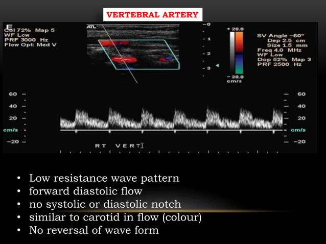 CAROTID DOPPLER STUDY | PPTX