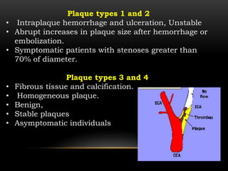 CAROTID DOPPLER STUDY | PPTX