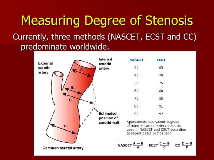 Carotid Imaging Modalities