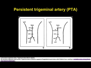 Carotid vertebral anastomosis | PPTX
