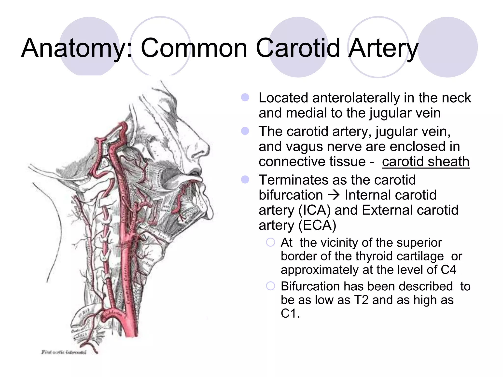 Carotid INTRODUCTION | PPT