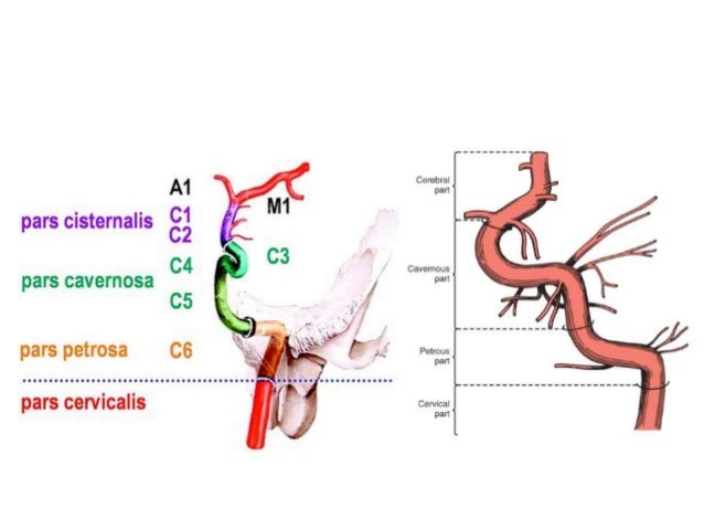 Carotid 360°