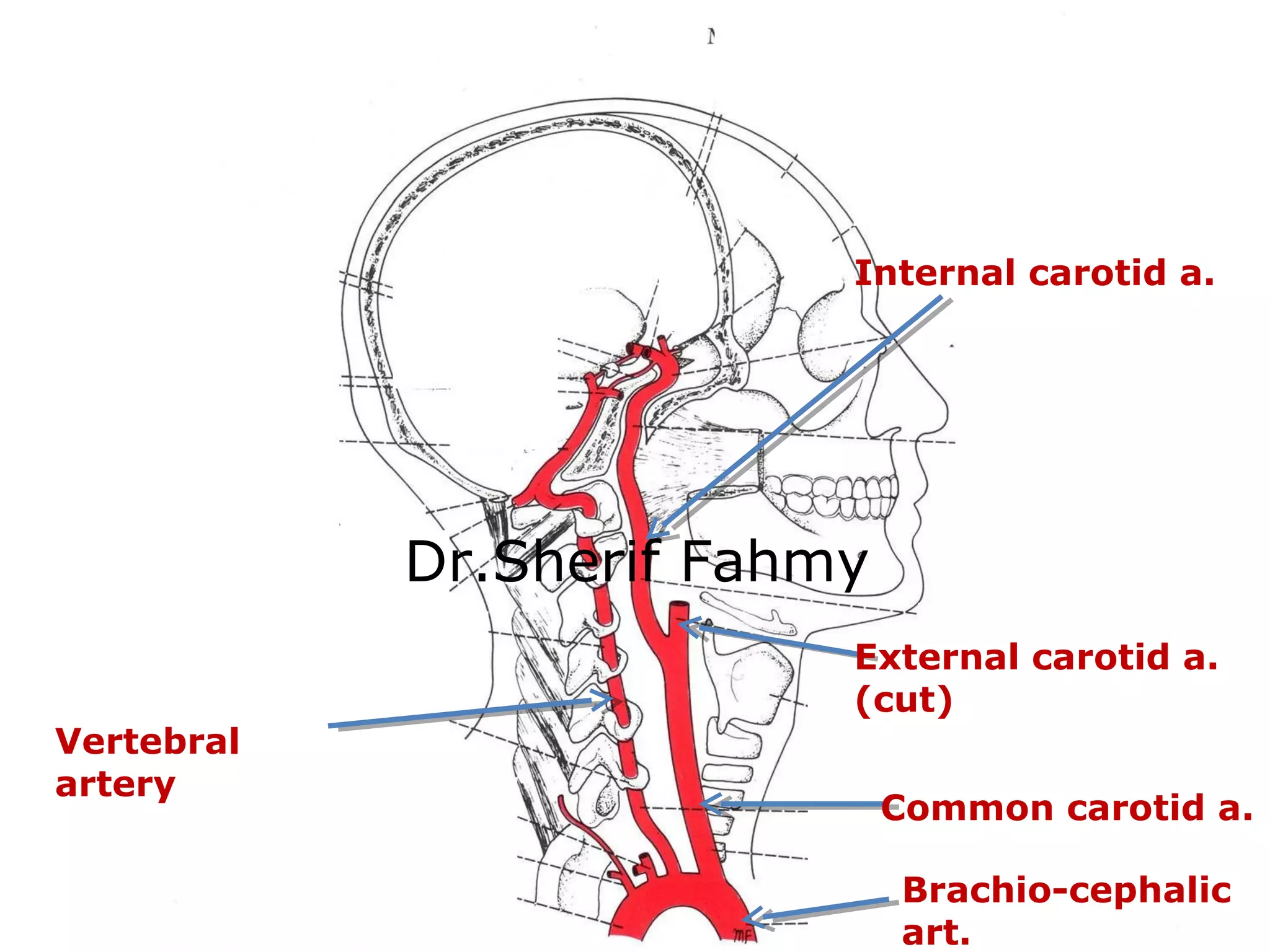 Carotid Arteries (Anatomy of the Neck) | PPS
