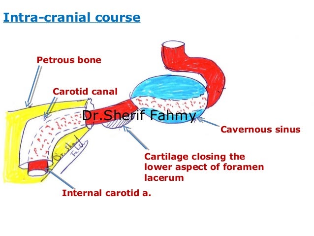 Carotid Arteries (Anatomy of the Neck)