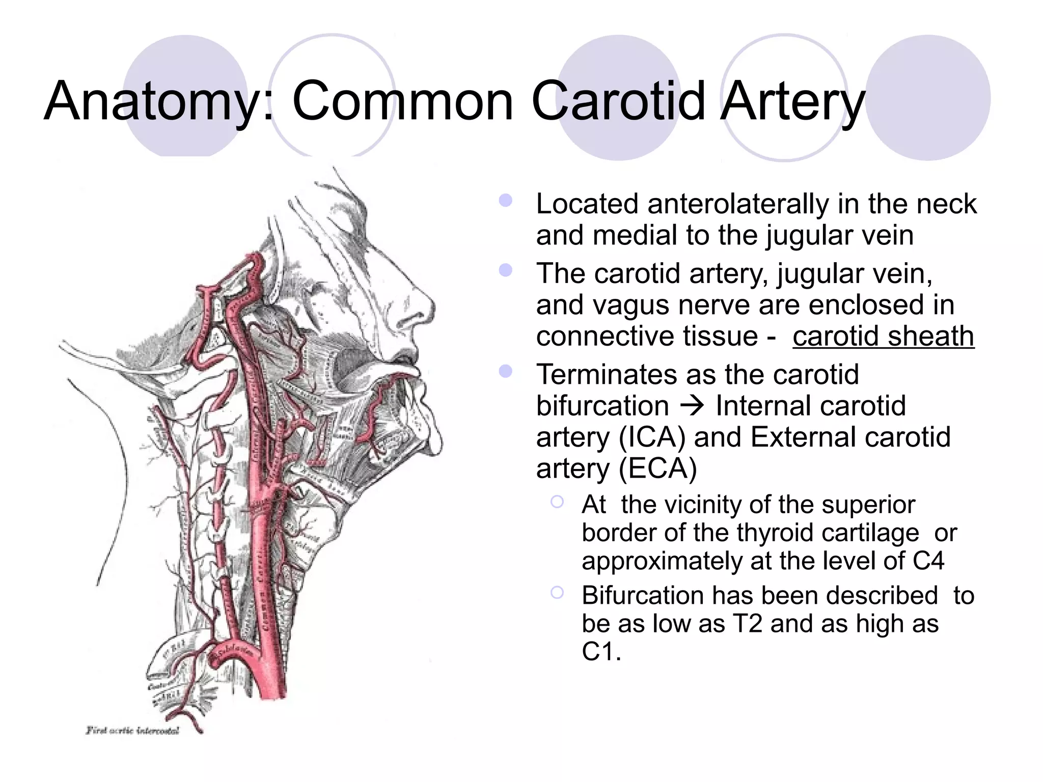 Carotid artery disease | PPT