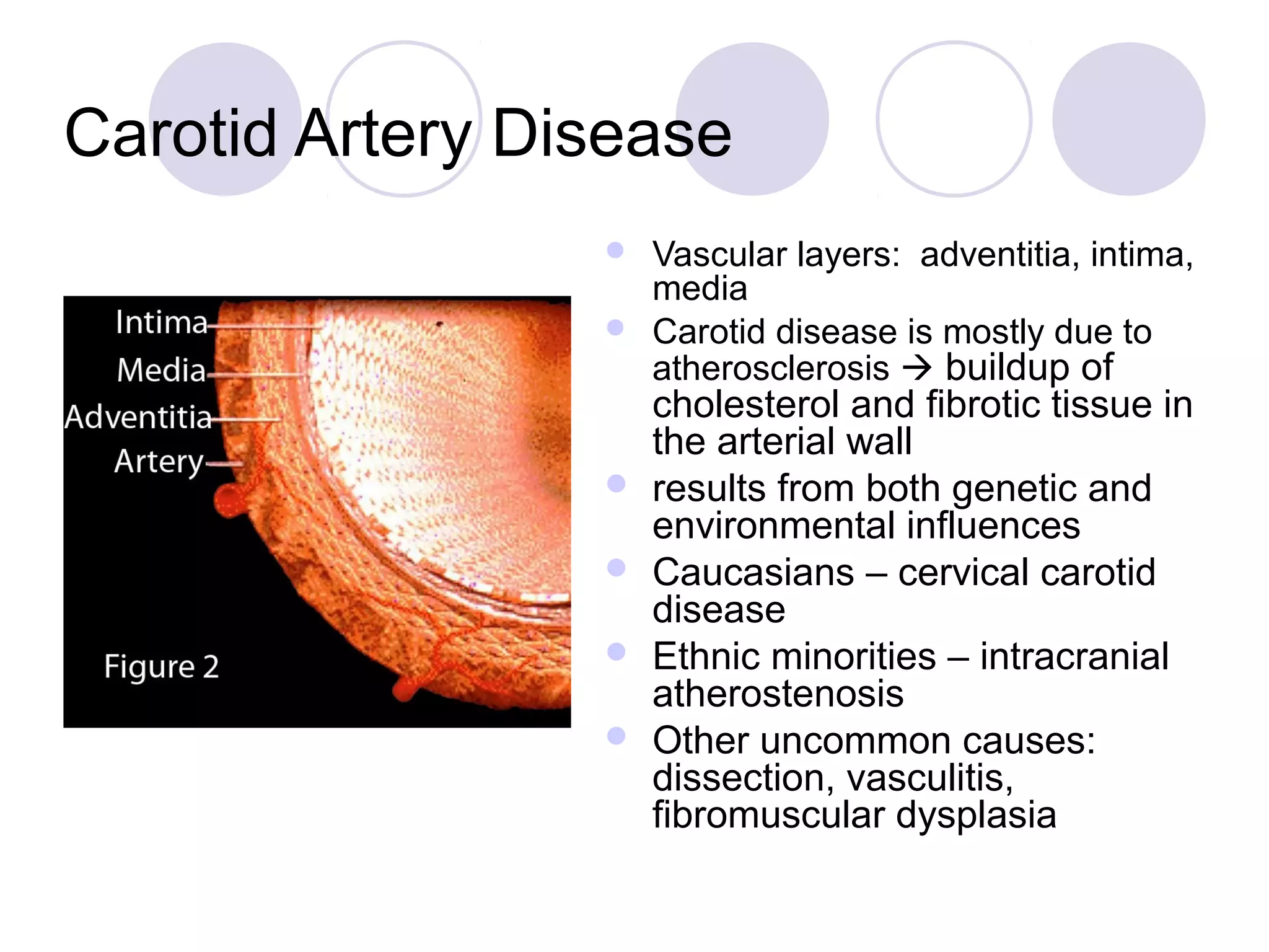 Carotid artery disease | PPT