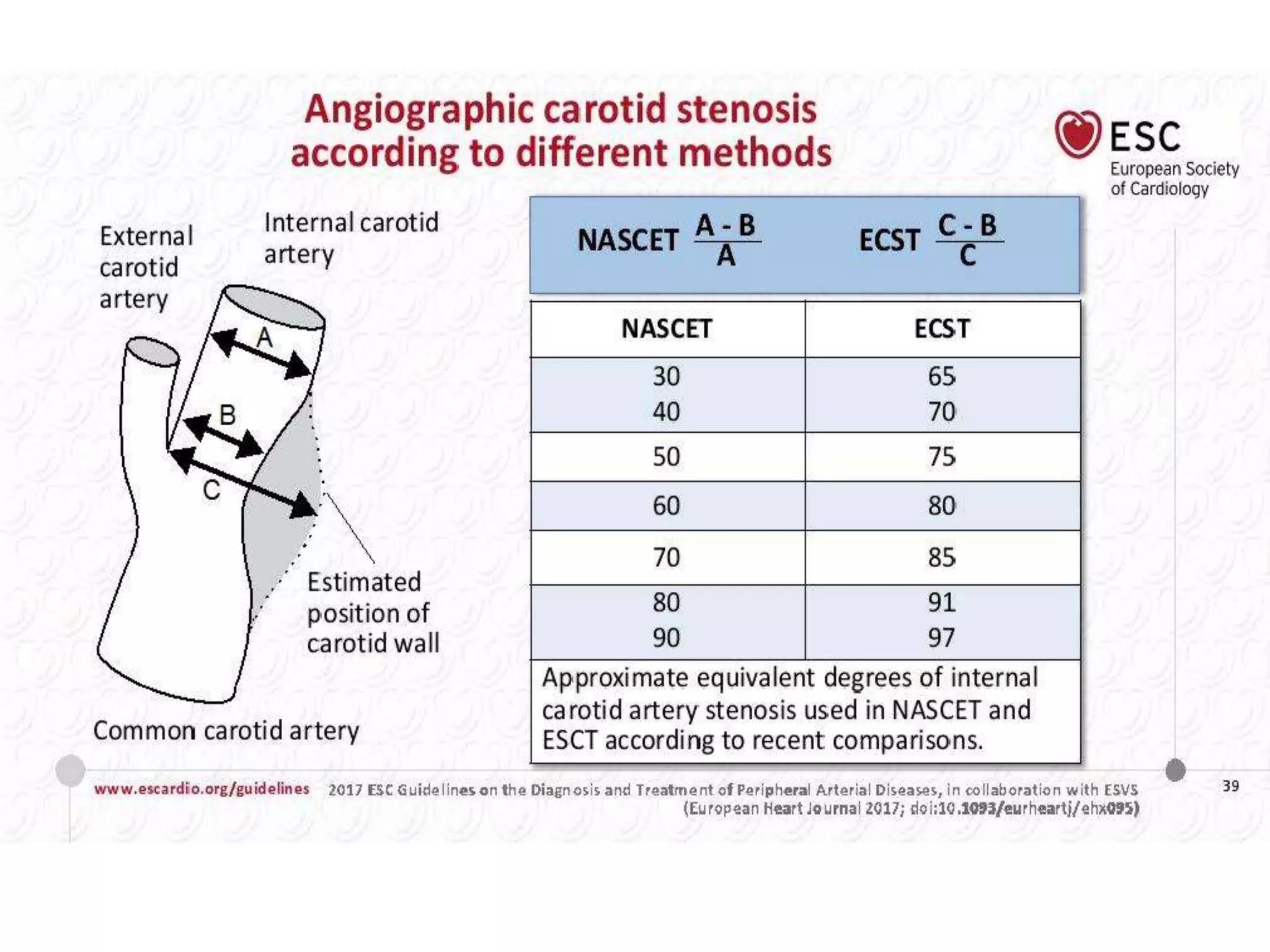 Carotid artery diseases and carotid stenting | PPTX