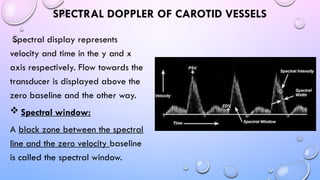 Carotid Doppler Ultrasound: Principles and Pitfalls | PPTX