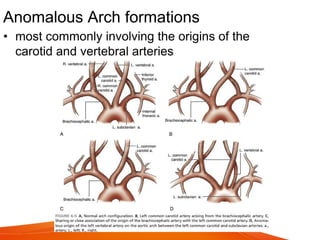 Carotid artery doppler study abdul | PDF
