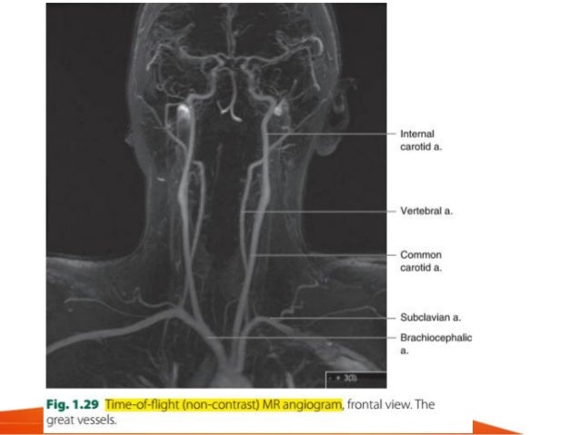 Carotid Doppler Ukrainepatient