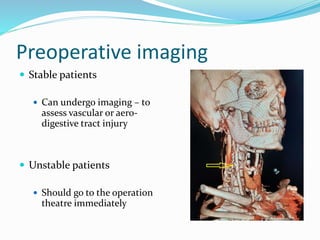 Carotid artery injuries, Joel Arudchelvam, SLSC 2022.pptx