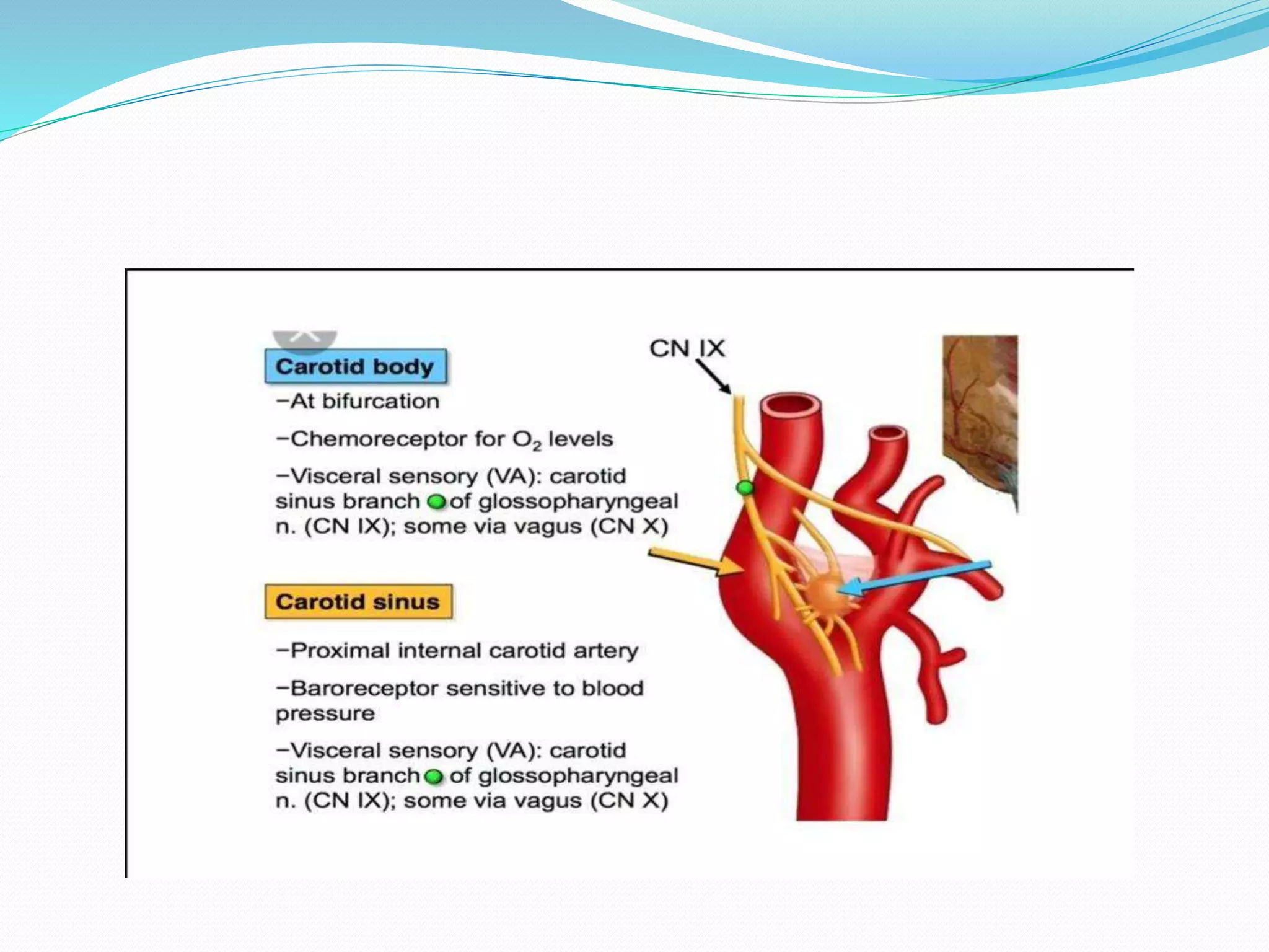 carotid body tumor.pptx