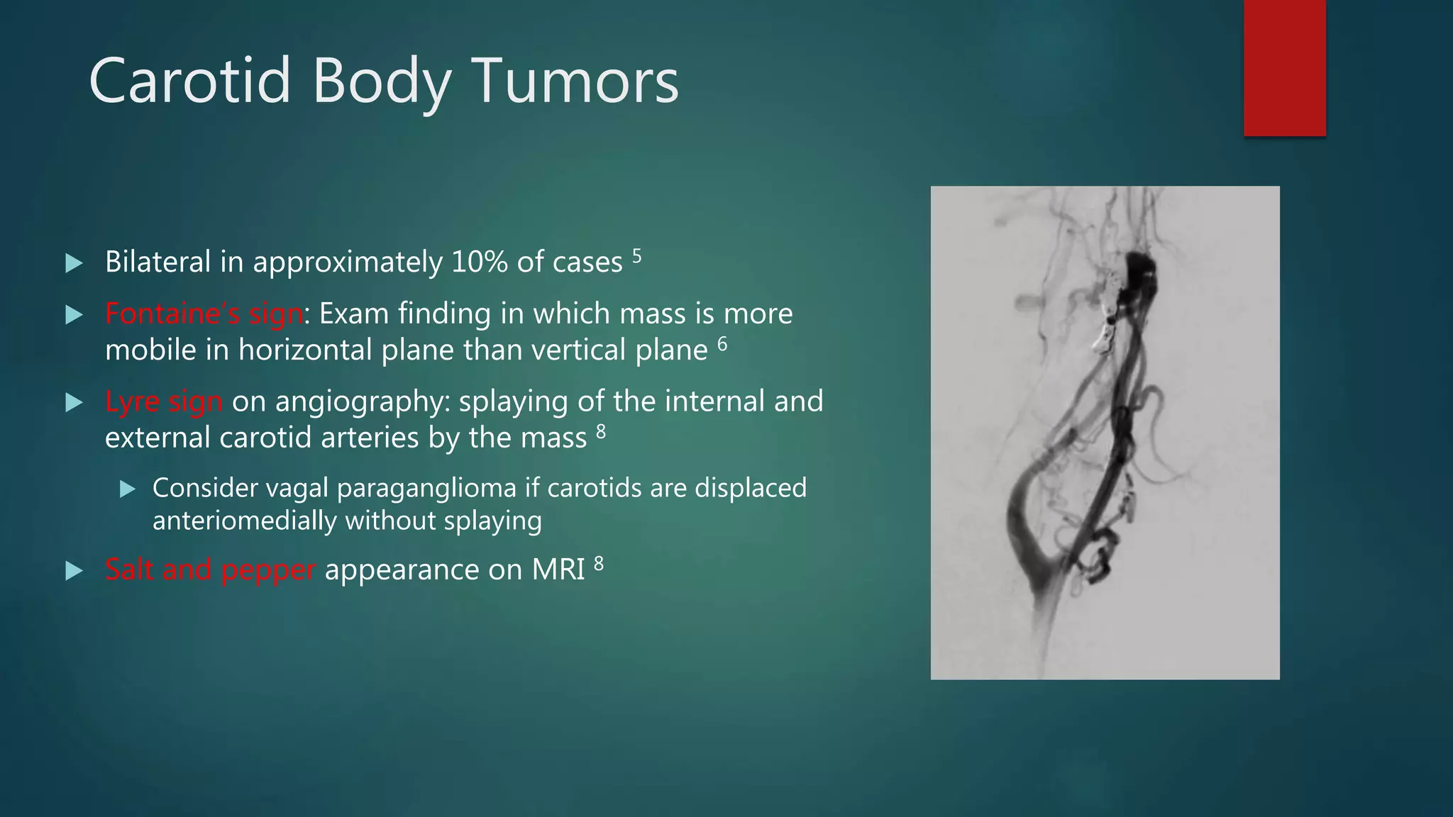 Carotid body tumors | PPTX