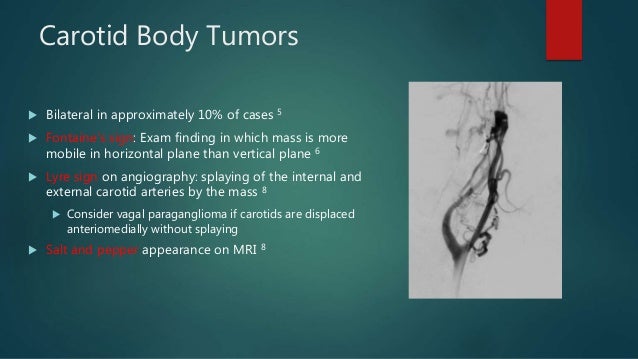 Carotid body tumors