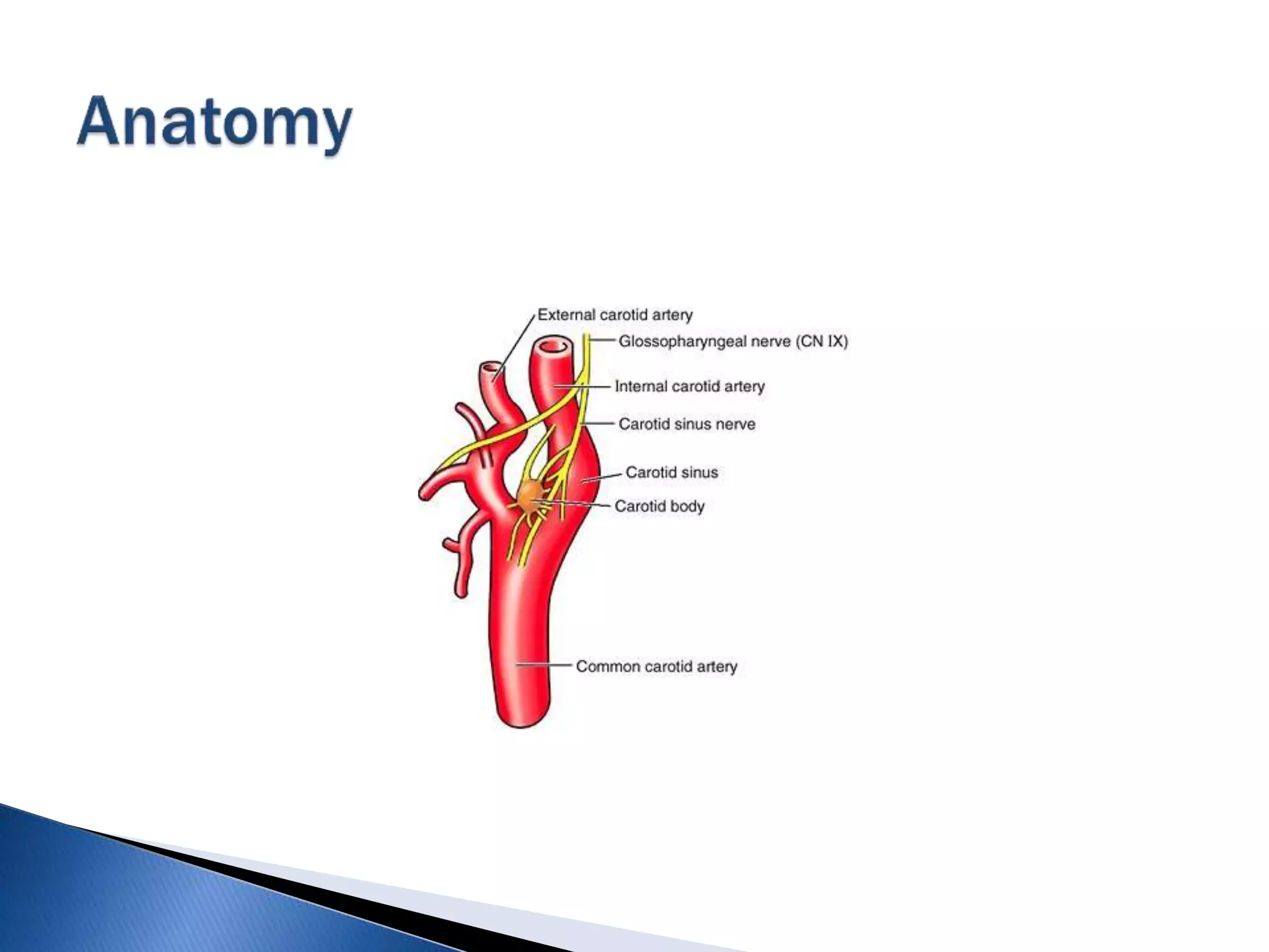 Carotid body tumour | PPTX