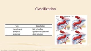 Carotid Cavernous Fistula | PPTX