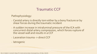 Carotid Cavernous Fistula | PPTX