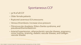 Carotid Cavernous Fistula | PPTX
