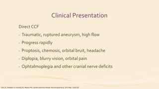 Carotid Cavernous Fistula | PPTX