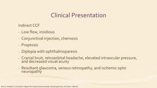 Carotid Cavernous Fistula | PPTX