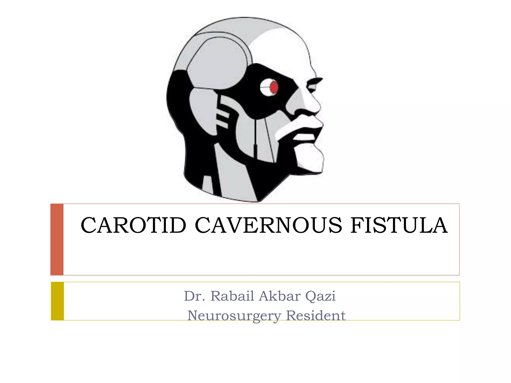 Carotid Cavernous Fistula | PPTX | First Aid | Injuries