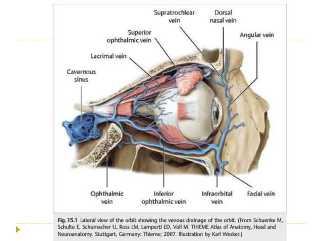Carotid Cavernous Fistula | PPTX | First Aid | Injuries