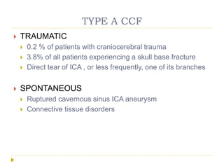 Carotid Cavernous Fistula | PPTX