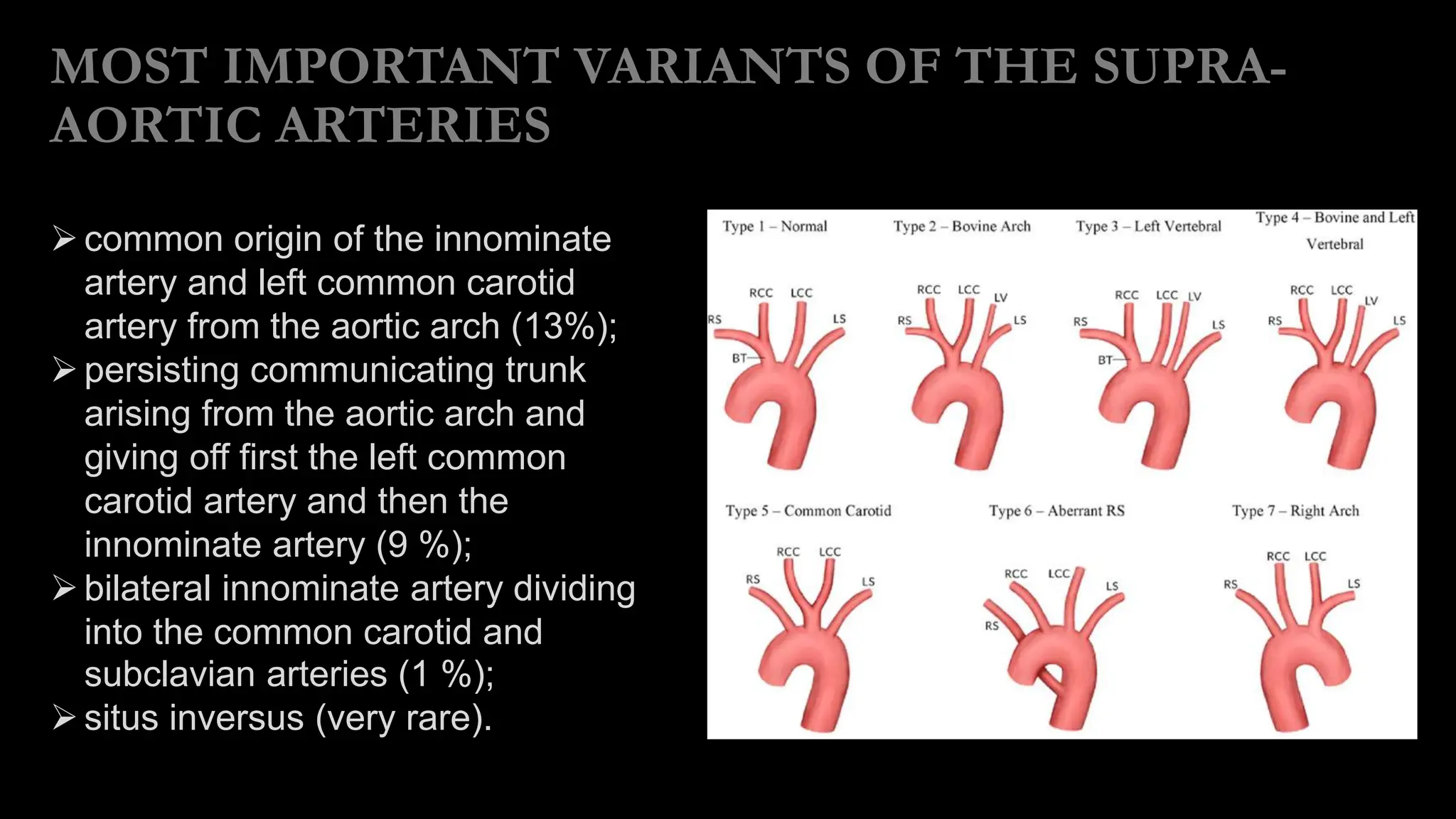 CAROTID DOPPLER BY DR NITIN WADHWANI | PPTX