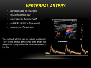 Carotid doppler Ultrasound | PPTX