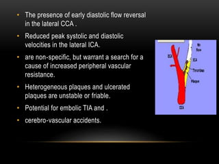 Carotid doppler Ultrasound | PPTX