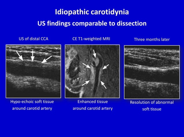 Carotid doppler II Dr. Muhammad Bin Zulfiqar | PPT