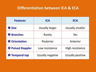 Carotid doppler ultrasound | PPTX