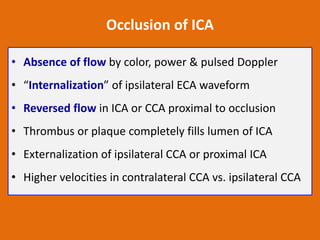 Carotid doppler ultrasound | PPTX