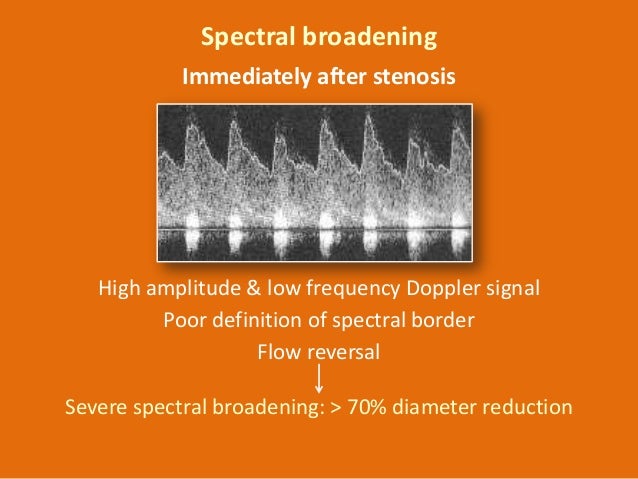 Carotid doppler ultrasound