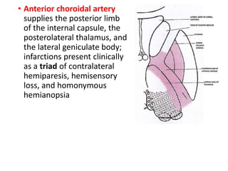 Carotid Occlusive Disease.pptx