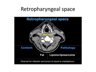 Carotid space tumour final.ppt
