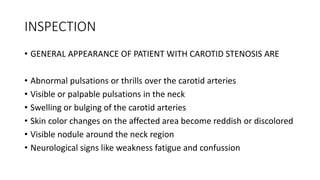 CAROTID STENOSIS .pptx