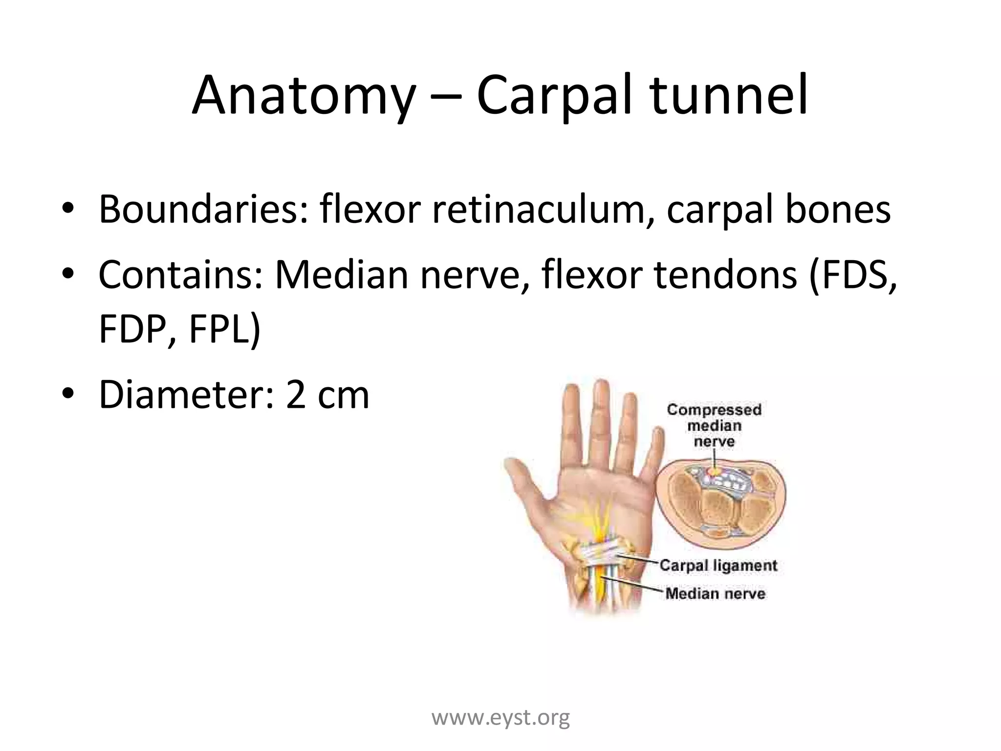 Carpal Tunnel Syndrome | PPT