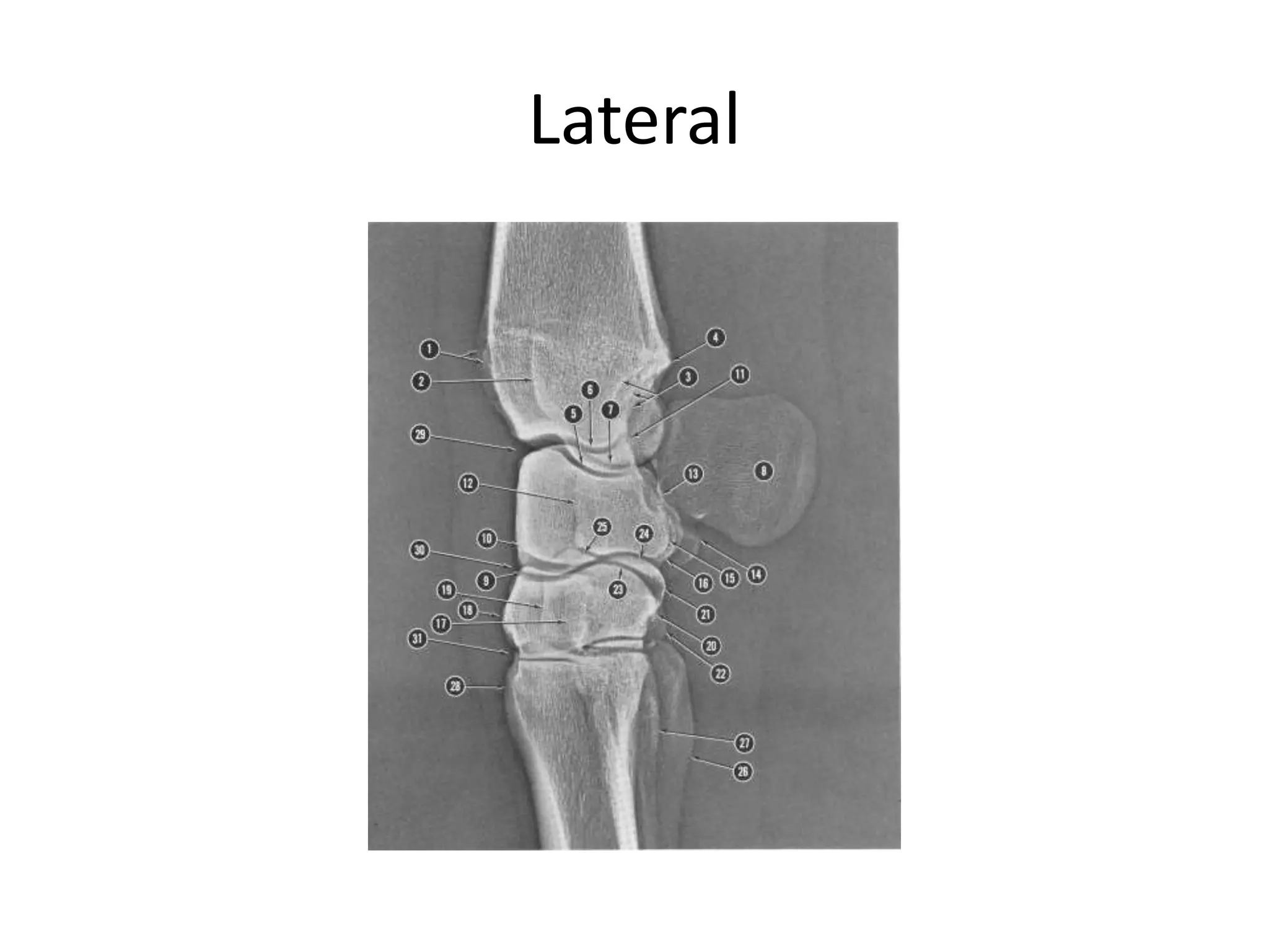Equine Carpus Anatomy | PPTX