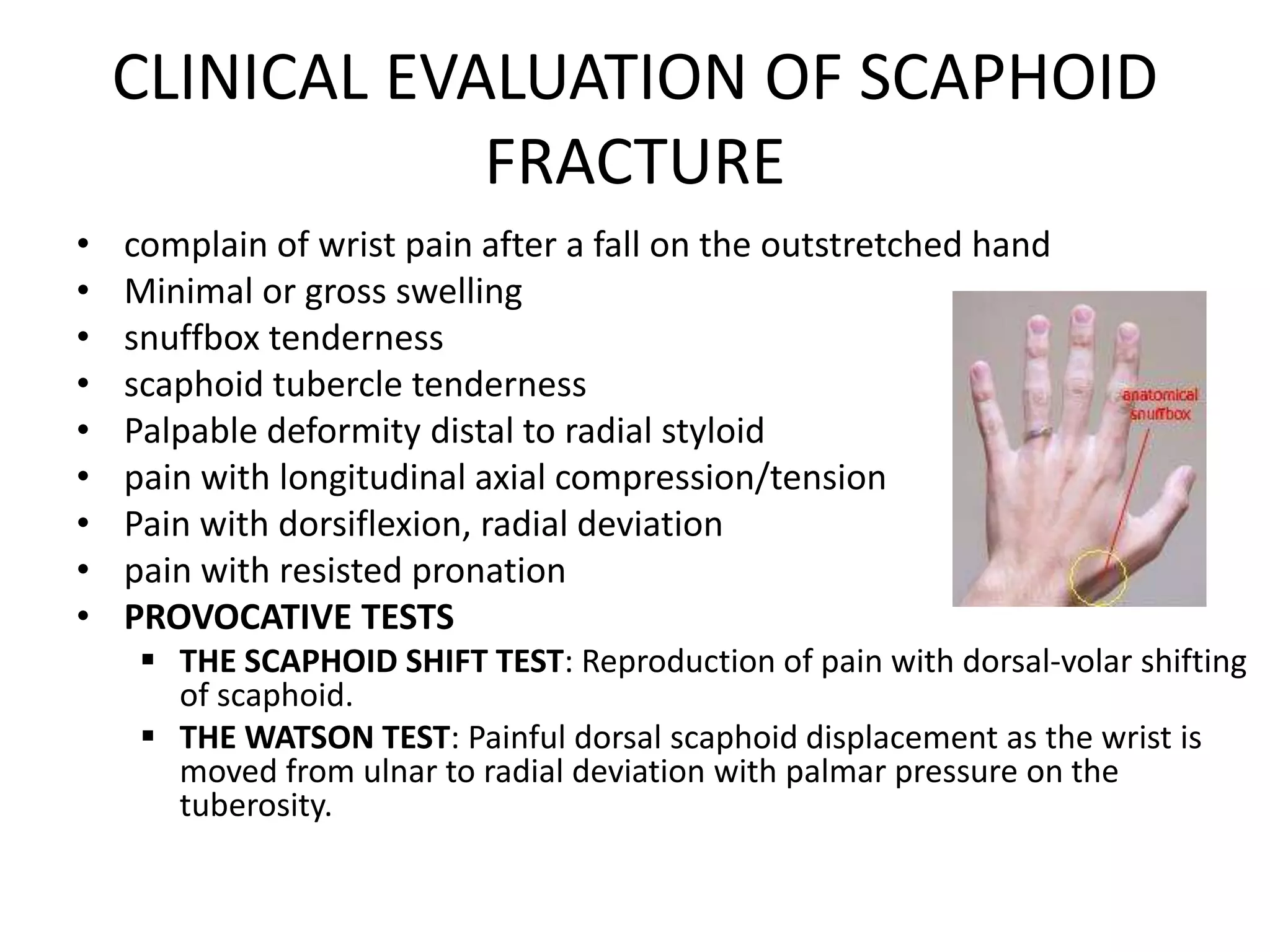 Carpal bone fractures | PPTX