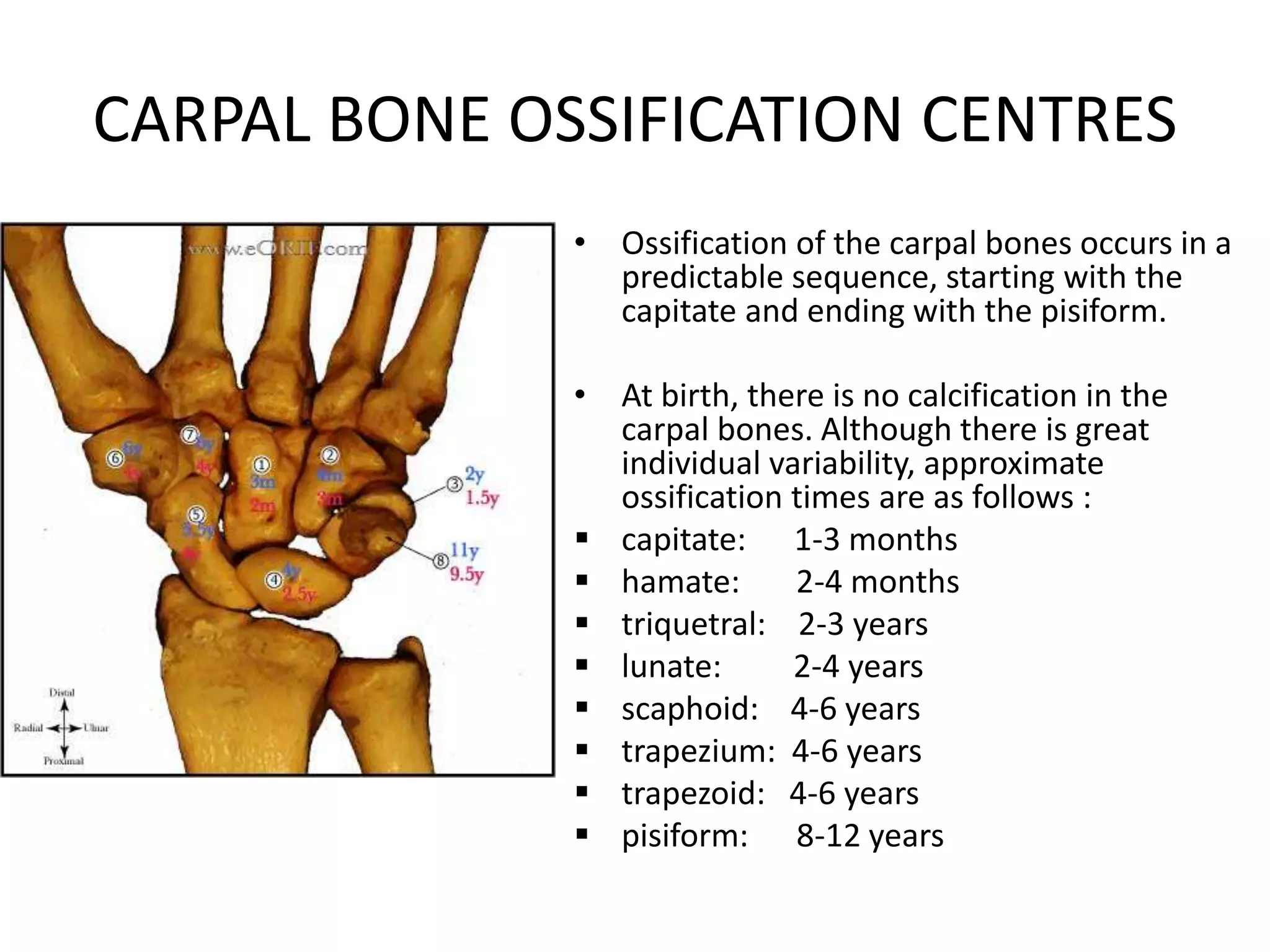 Carpal bone fractures | PPTX