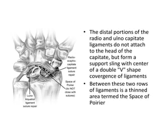 Carpal bone fractures | PPTX