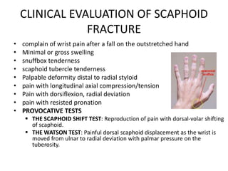 Carpal bone fractures | PPT