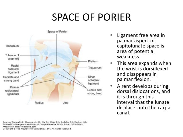 Carpal bone fractures