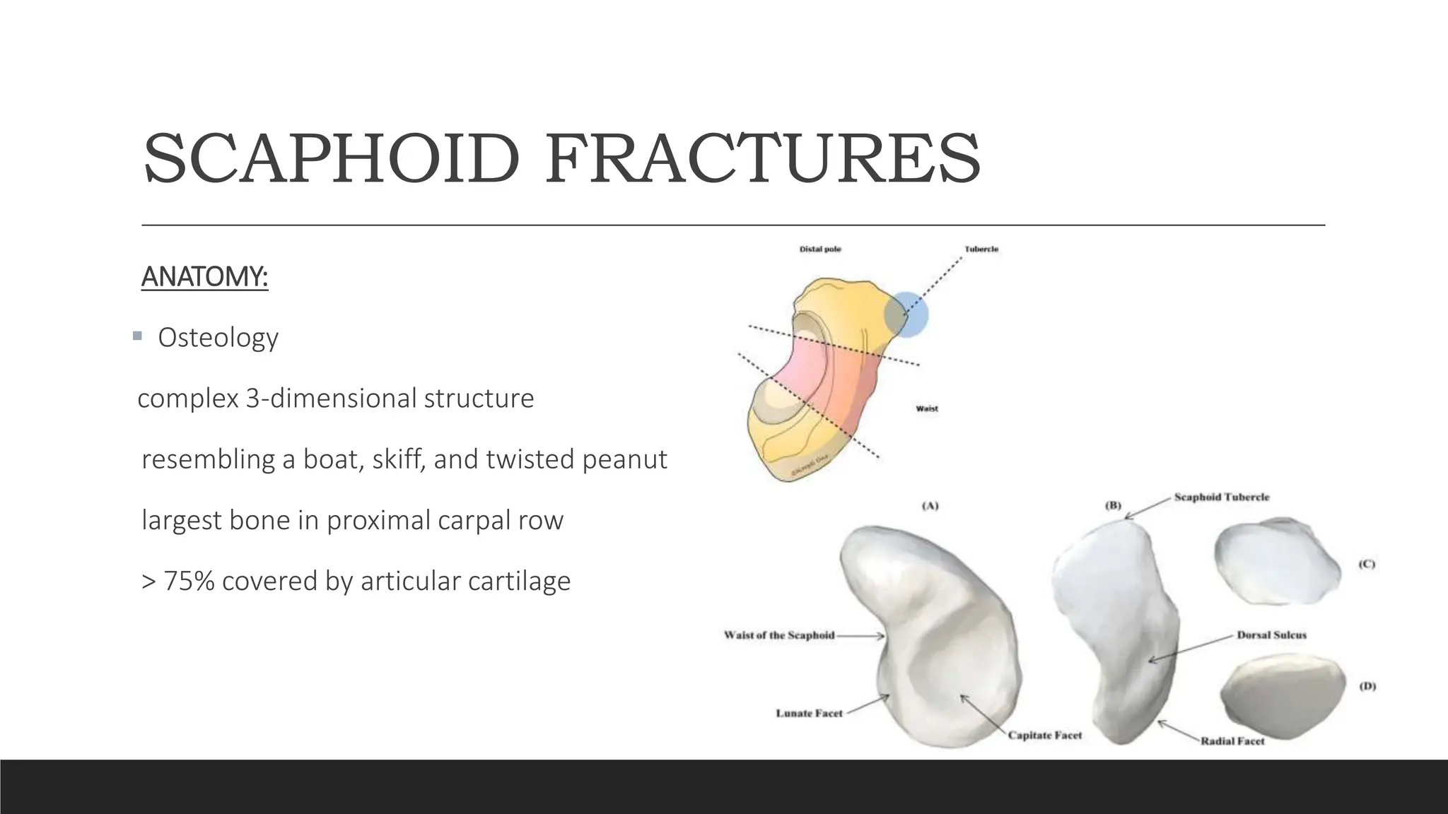 CARPAL BONES FRACTURES GENERALITES.pptx