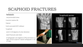 CARPAL BONES FRACTURES GENERALITES.pptx
