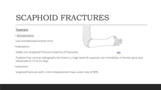 CARPAL BONES FRACTURES GENERALITES.pptx