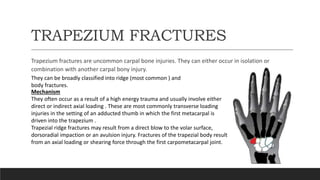 CARPAL BONES FRACTURES GENERALITES.pptx
