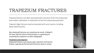 CARPAL BONES FRACTURES GENERALITES.pptx