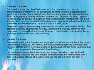 Carpal Fractures | PPT